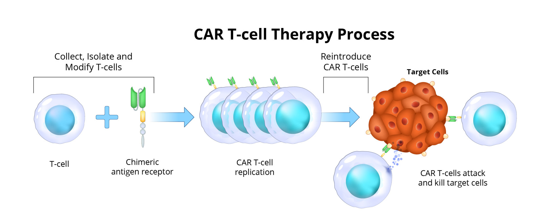 CAR T-Cell Therapy: A New Frontier for Treating Autoimmune Diseases ...